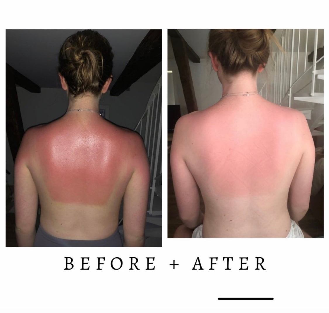 Skin Saviors you shouldn't miss! – Clary Collection